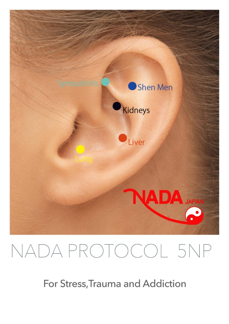 NADA プロトコル5NPのポスターができました – 一般社団法人NADA JAPAN